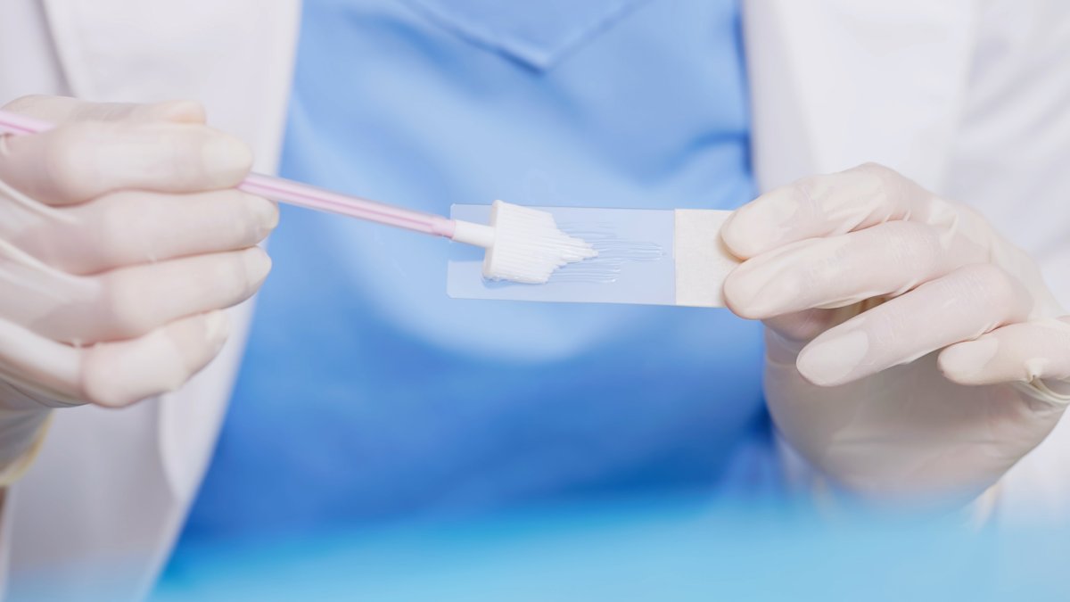Pruebas de VPH desde casa ofrecen una alternativa al papanicolaou ...